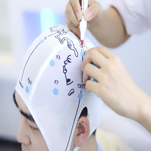 TMS Positioning Cap – Pack of 10 | 10-20 Coil Placement Tool | Caputron